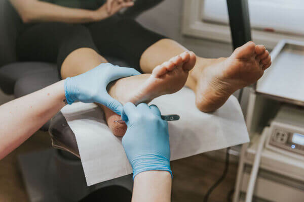 Skin & Nails - Evolve Podiatry Bendigo